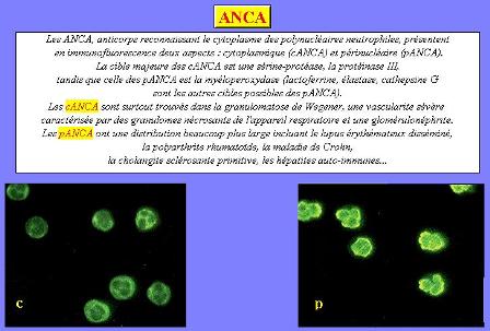 Dosage des auto-anticorps | Médecine intégrée