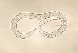 Anémie et parasitoses | Médecine intégrée