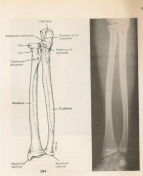 Le Squelette (Marieb ch.7) | Médecine intégrée