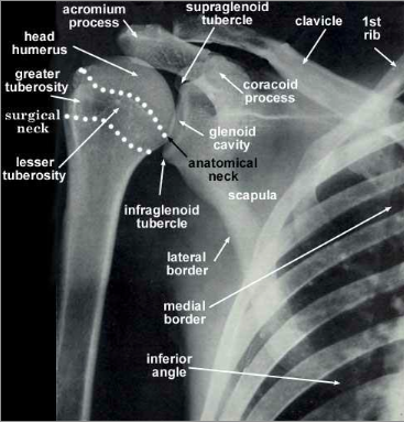 Les articulations (Marieb ch.8) | Médecine intégrée